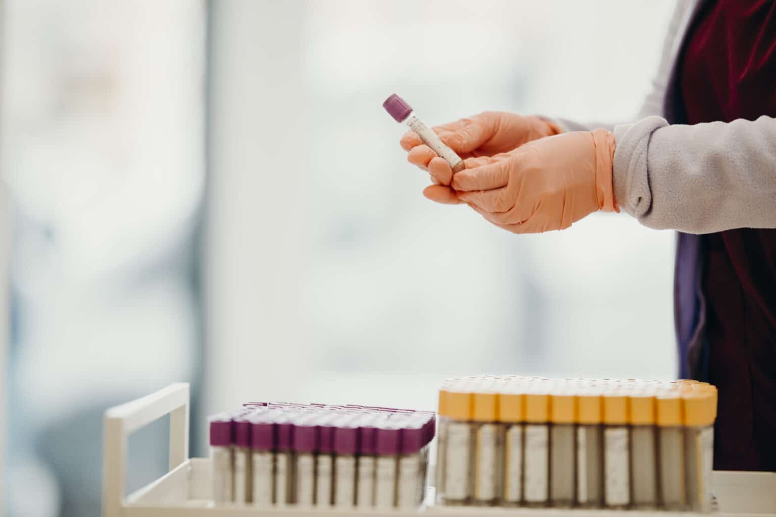 Blood Test Clinic - E&S Doctors